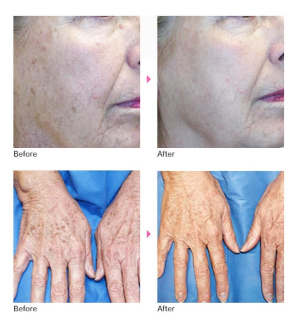 メディカルエステティック｜荒田ひふ科クリニック